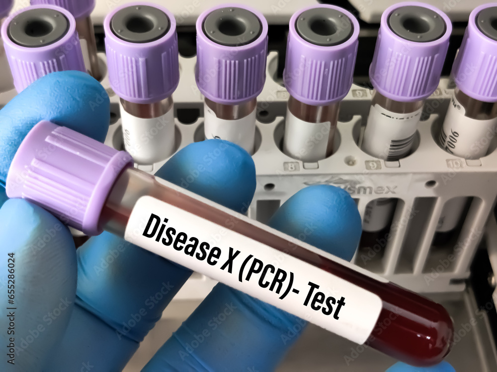 Blood sample for Disease X test. Disease X is the mysterious name given ...