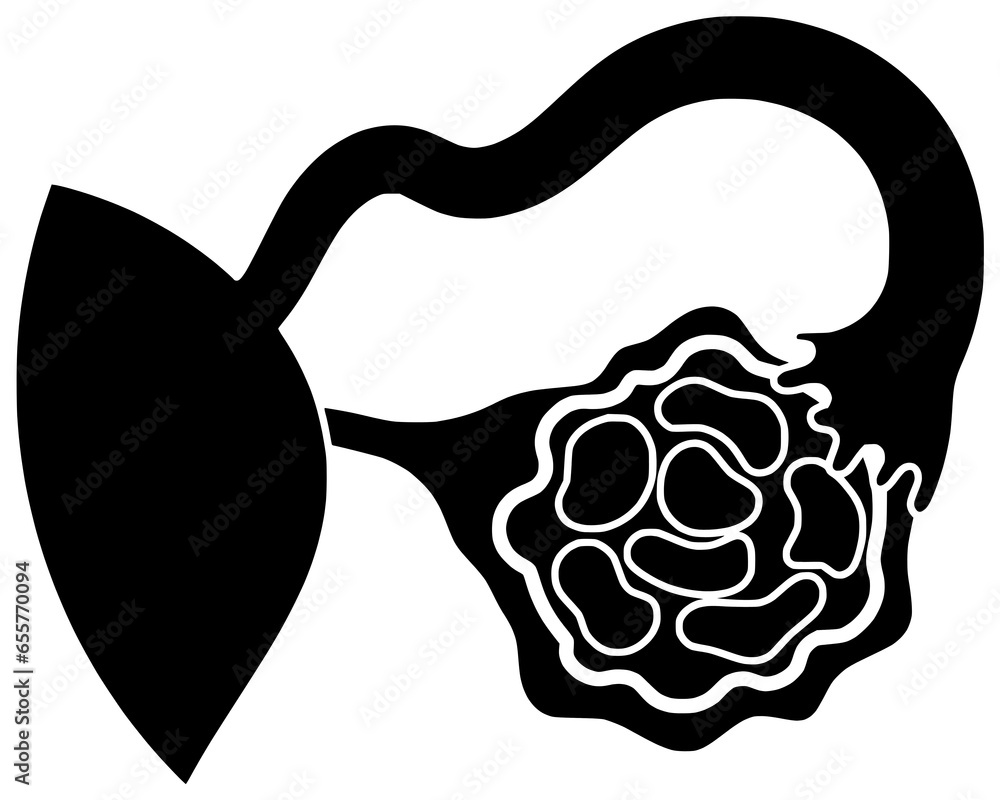 women black womb silhouette cancer illustration acute icon skirt logo ...