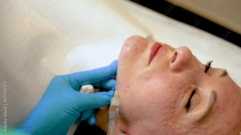 Doctor cosmetologist hands in gloves making multiple injections in ...