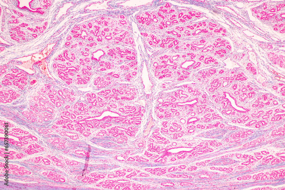 Histological Rectum human, Gall bladder human and Urethra Human under ...