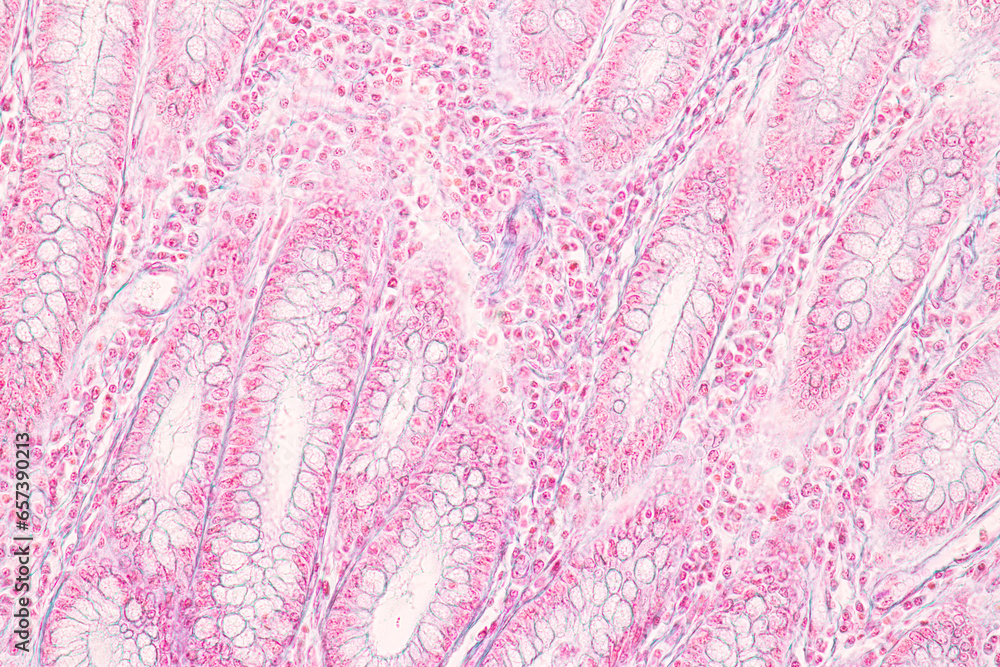 Histological Rectum human, Gall bladder human and Urethra Human under ...