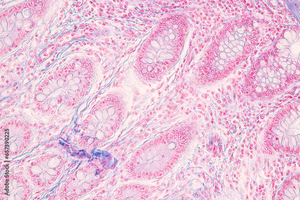Histological Rectum human, Gall bladder human and Urethra Human under ...