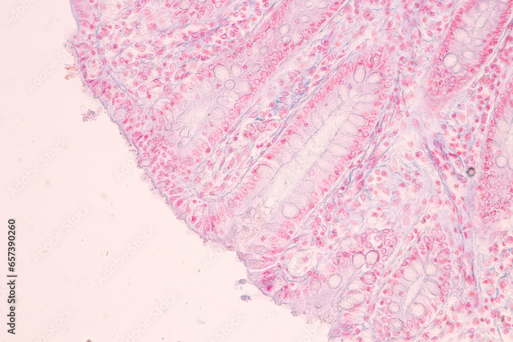 Histological Rectum human, Gall bladder human and Urethra Human under ...