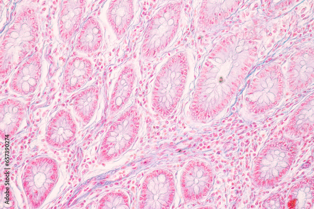 Histological Rectum human, Gall bladder human and Urethra Human under ...