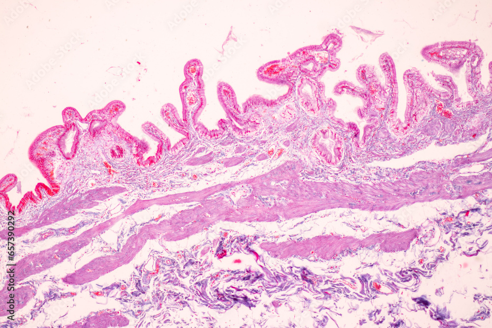 Histological Rectum human, Gall bladder human and Urethra Human under ...