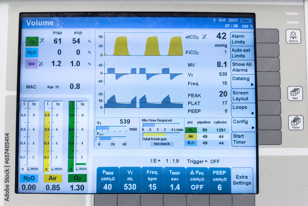 Medical monitor displays vital signs with graphs and numbers, heart ...