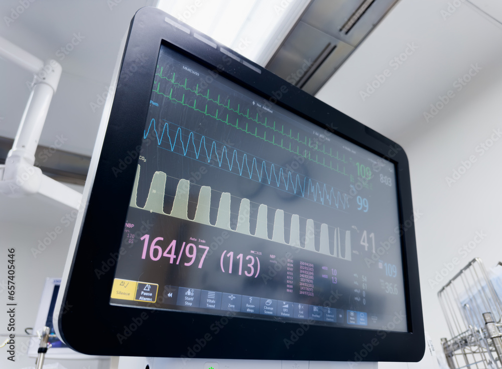 Medical monitor displays vital signs with graphs and numbers, heart ...