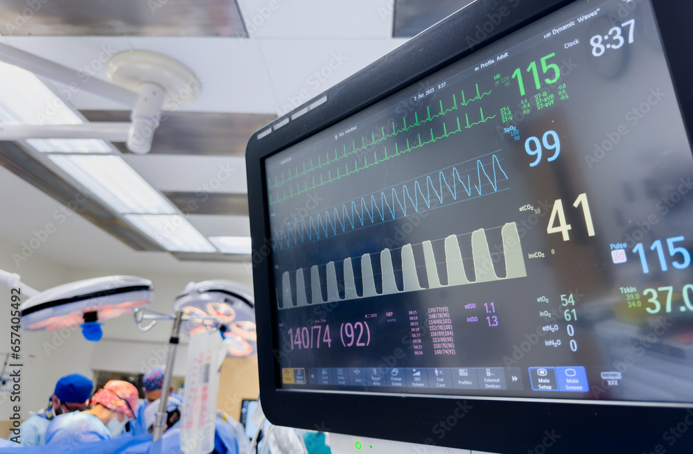 Medical monitor displays vital signs with graphs and numbers, heart ...