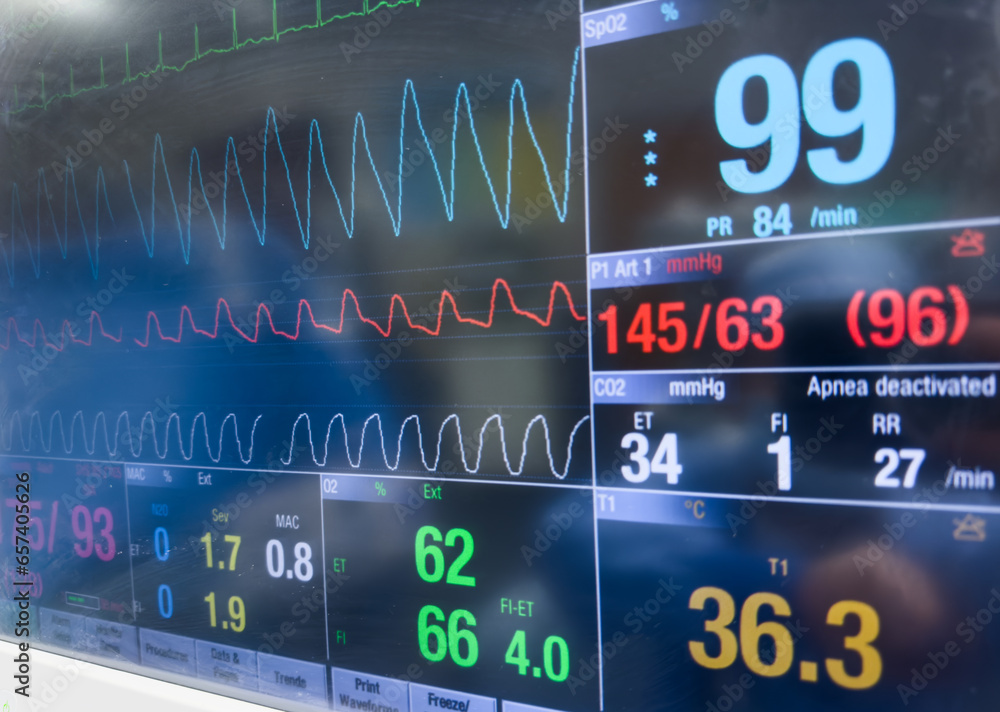 Medical monitor displays vital signs with graphs and numbers, heart ...