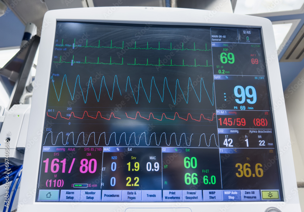 Medical monitor displays vital signs with graphs and numbers, heart ...