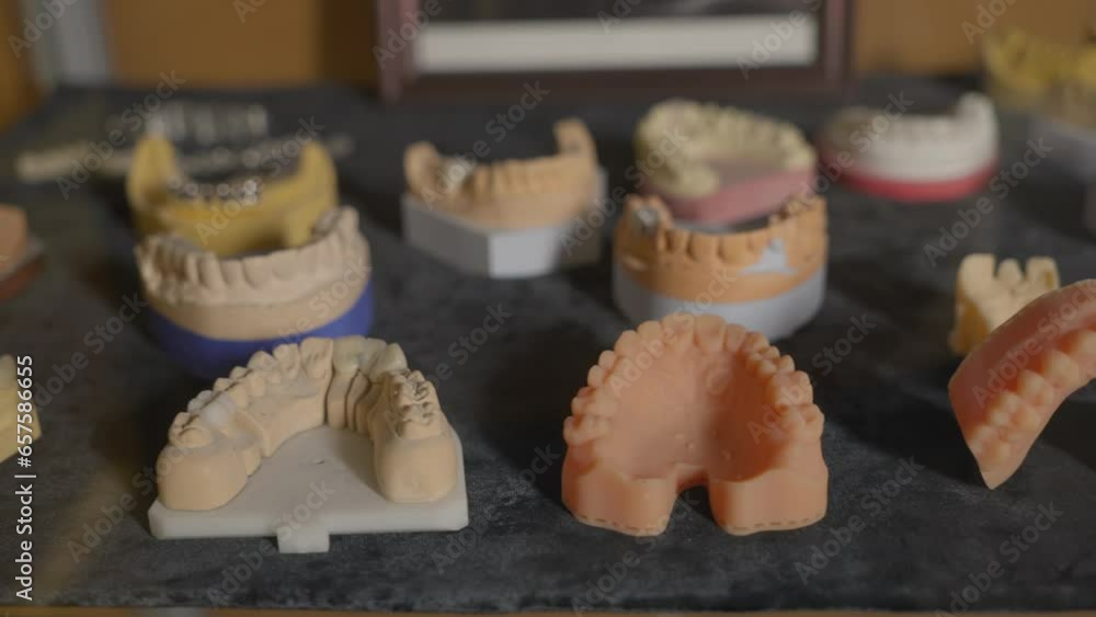 Multiple dental casts with fake teeth manufactured at the lab. Dental ...