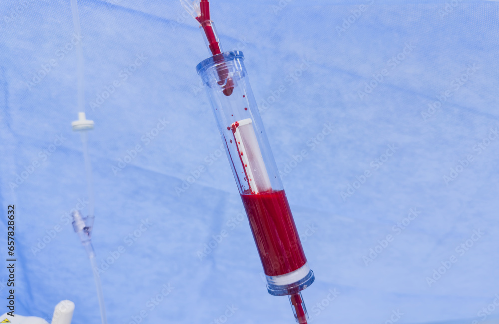 hospital IV drip, with translucent tubing and liquid medication flowing ...