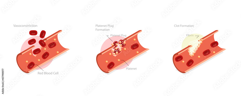 3D Isometric Flat Conceptual Illustration of Hemostasis, Wound Healing ...