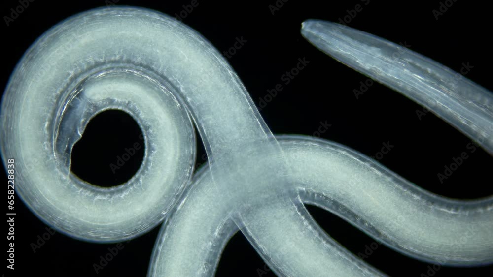 worm Nematoda under microscope, Phylum Protostomia, free-living ...