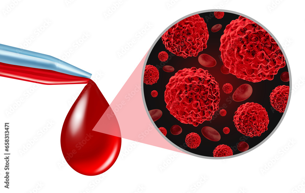 Blood Cancer screening Test as an Oncology medical diagnosis for tumor ...