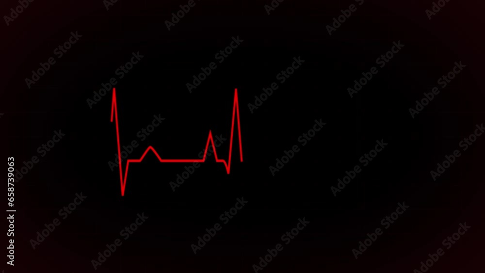 Normal ECG wave. Electrocardiogram show heart beat line animation ...