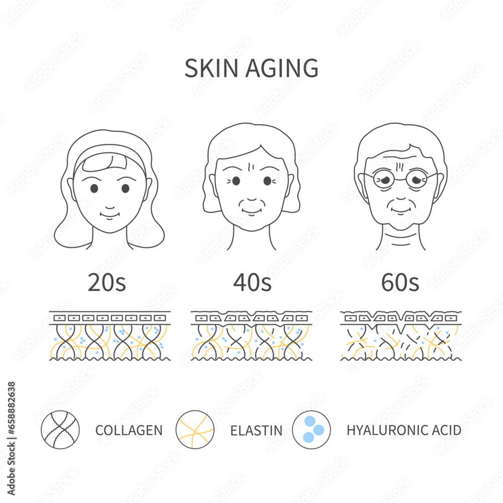 Skin aging process showing reduction of collagen, elastin and ...