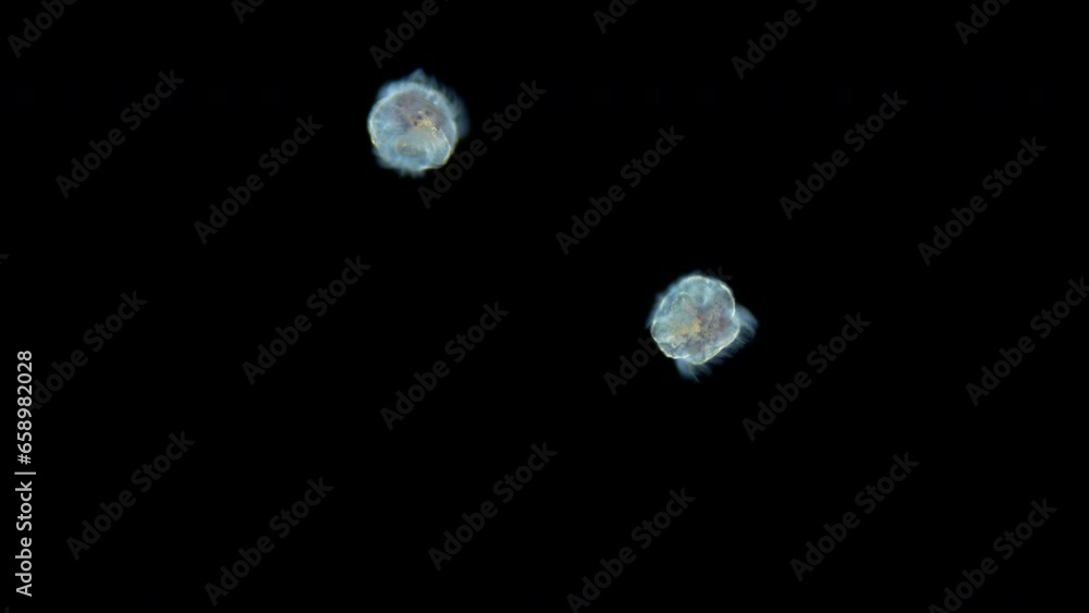 Polychaeta larva worm Capitellidae family under microscope. Possibly ...