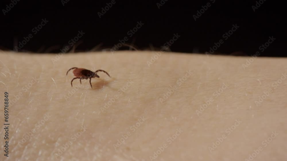 Parasitic tick walks awkwardly over human skin with front legs up ...