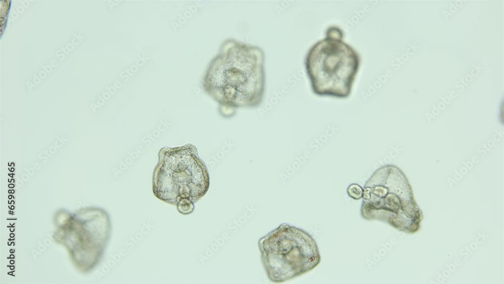 Larvae sea urchin Strongylocentrotus pallidus under microscope, phylum ...