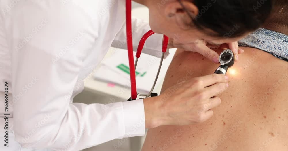 Doctor dermatologist oncologist examines moles through magnifying glass ...