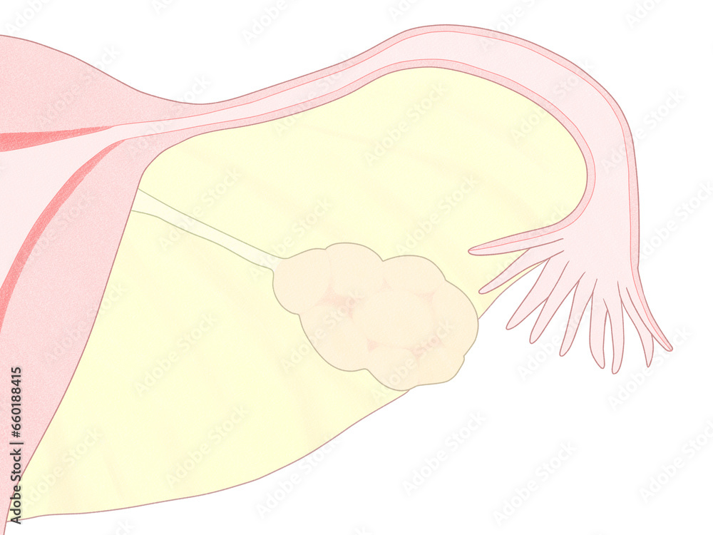 Fallopian tube anatomy; Female reproductive system PNG Stock ...