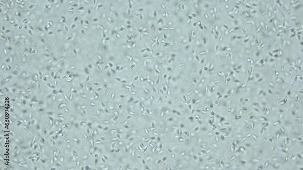 Sperm (spermotozoa) sea urchin Strongylocentrotus pallidus under ...