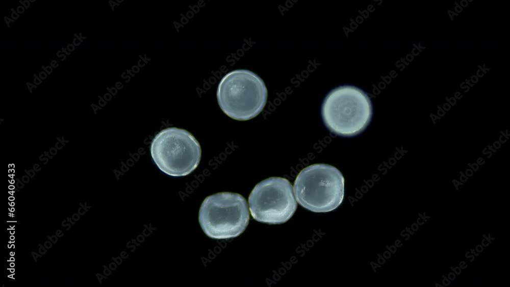 Larva sea urchin Strongylocentrotus pallidus under microscope, phylum ...