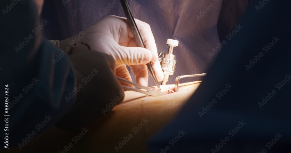 Close up of professional medics operate patient in surgery room ...