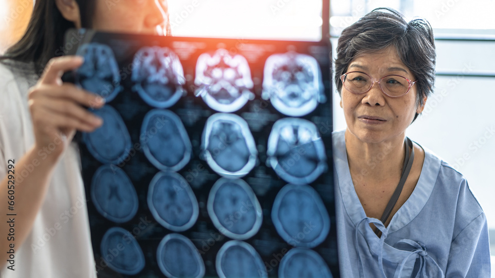 Brain disease diagnosis with medical doctor diagnosing elderly ageing ...