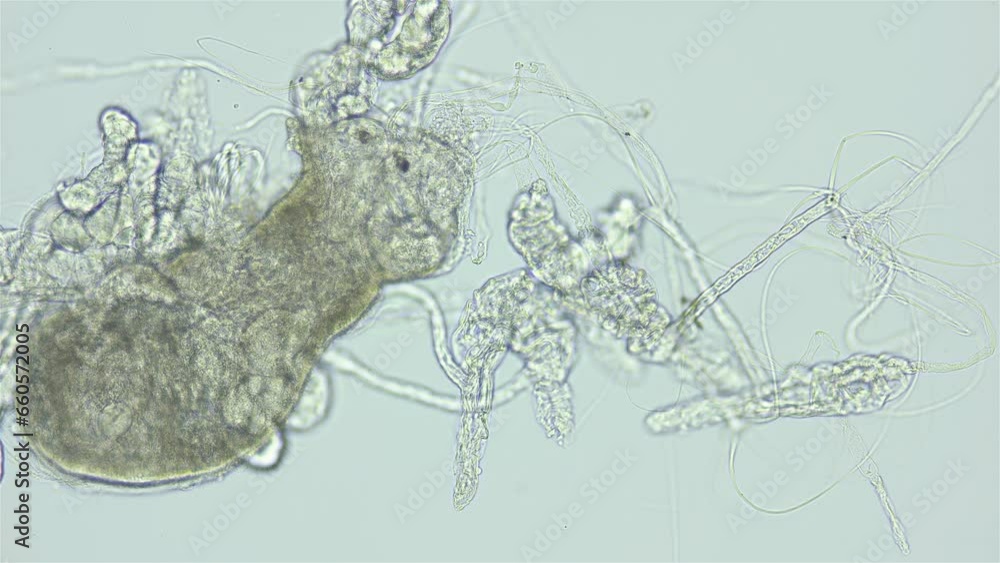 Larvae of parasitic worm Progonus muelleri under a microscope, at ...