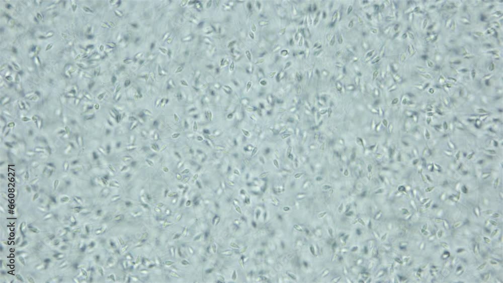 Sperm (spermotozoa) sea urchin Strongylocentrotus pallidus under ...