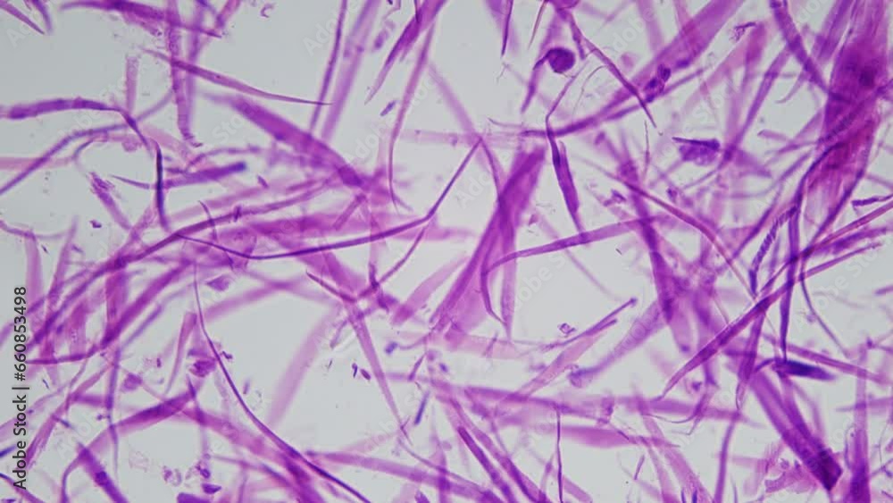 A bundle of human smooth muscle fibers under a microscope. The main ...