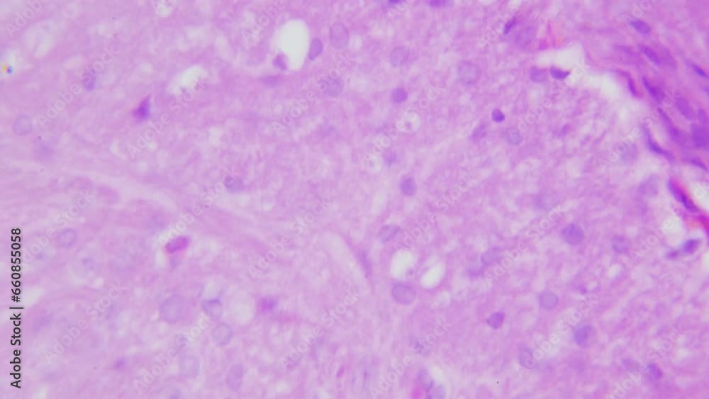 Human nerve bundle under microscope. Cross section. Smooth movement and ...