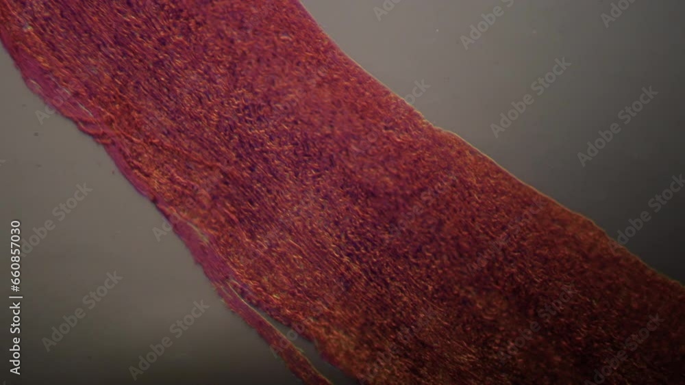 Human artery specimen. HQ video under microscope with 400x times ...