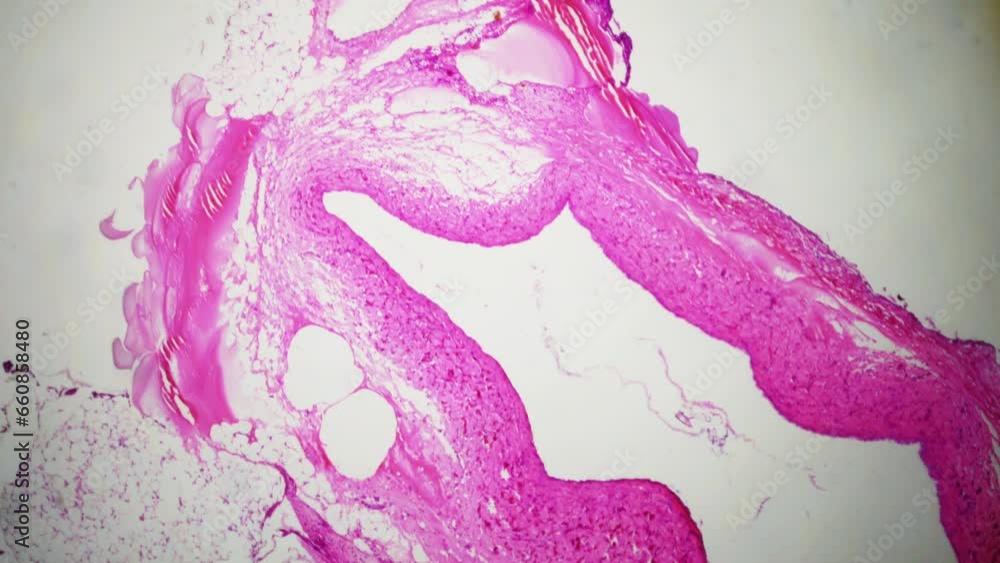 Human Vein specimen, multiple magnification under a microscope. High ...