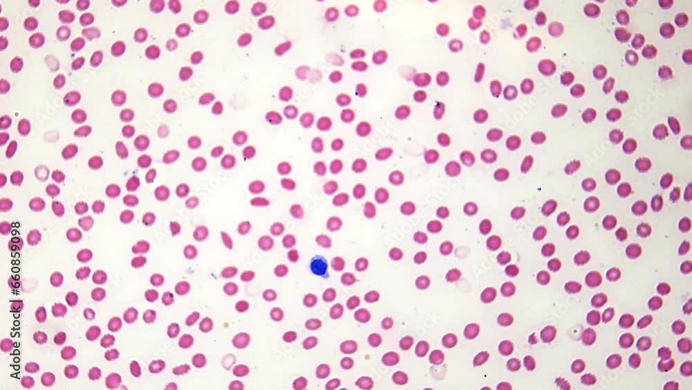 RBC and WBC under microscope. Science class. Observation of human blood ...