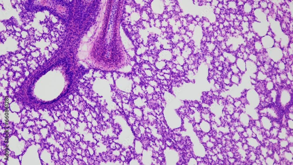 The process of gas exchange in the human lungs. Light tissue section ...