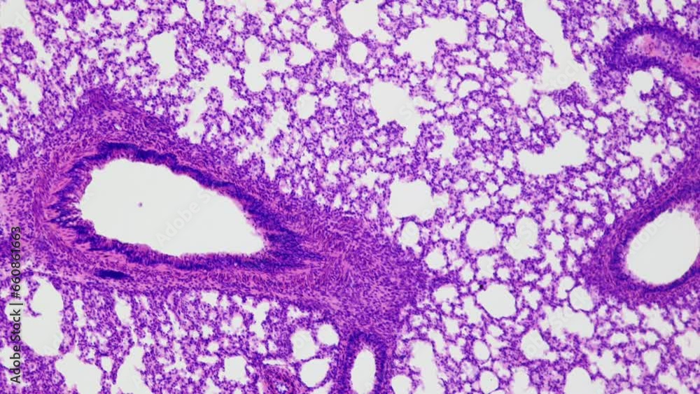 The process of gas exchange in the human lungs. Light tissue section ...