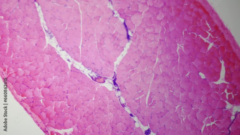 Human skeletal muscle under a microscope. Cross section of the sample ...