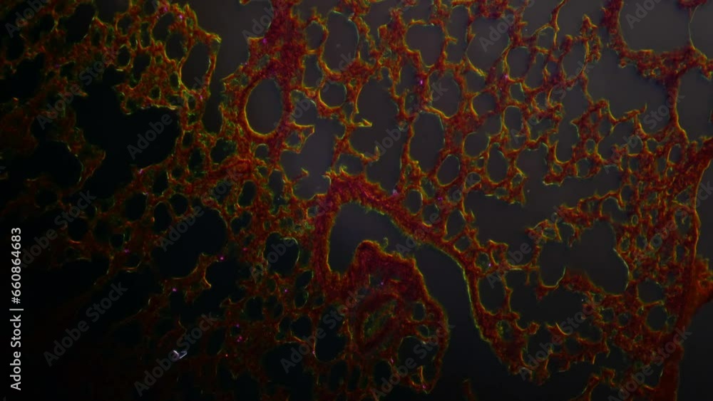 The thinnest section of a human lung under a microscope. Dark-field ...