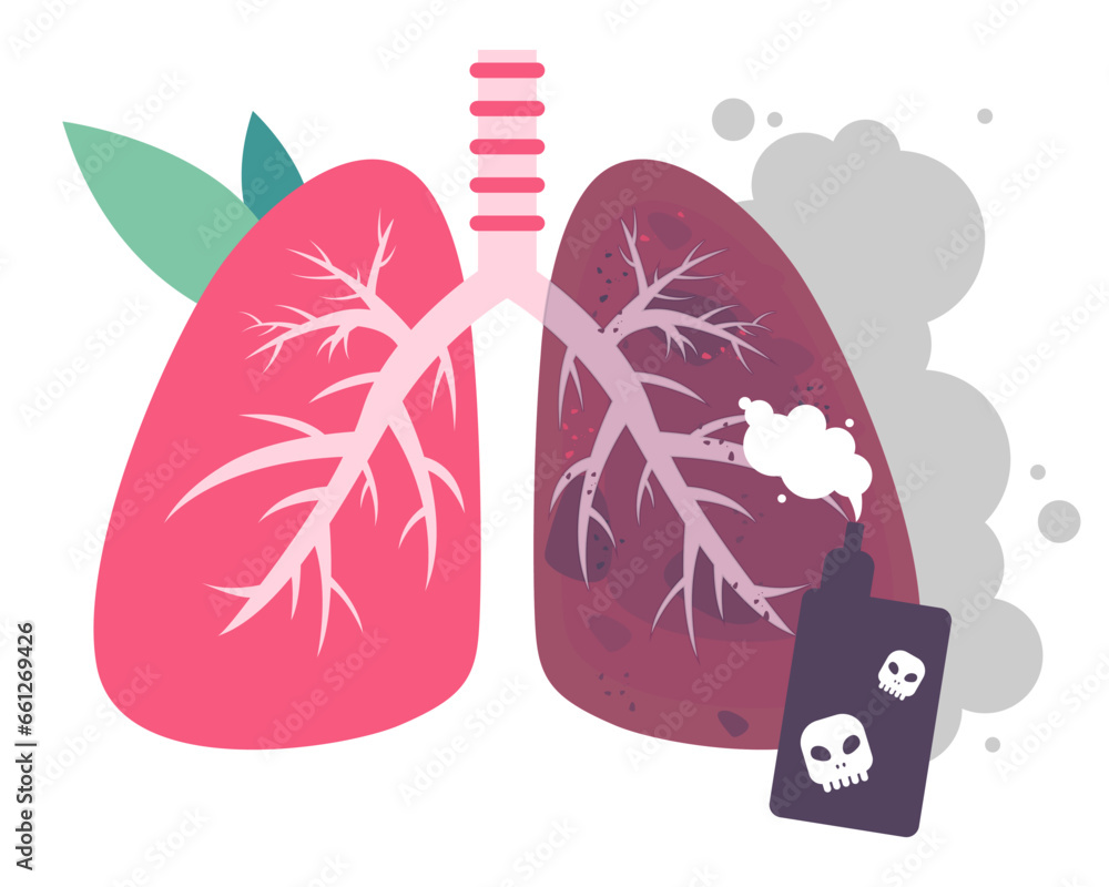 Healthy and damaged lungs vector illustration. Smoking vapes and ...