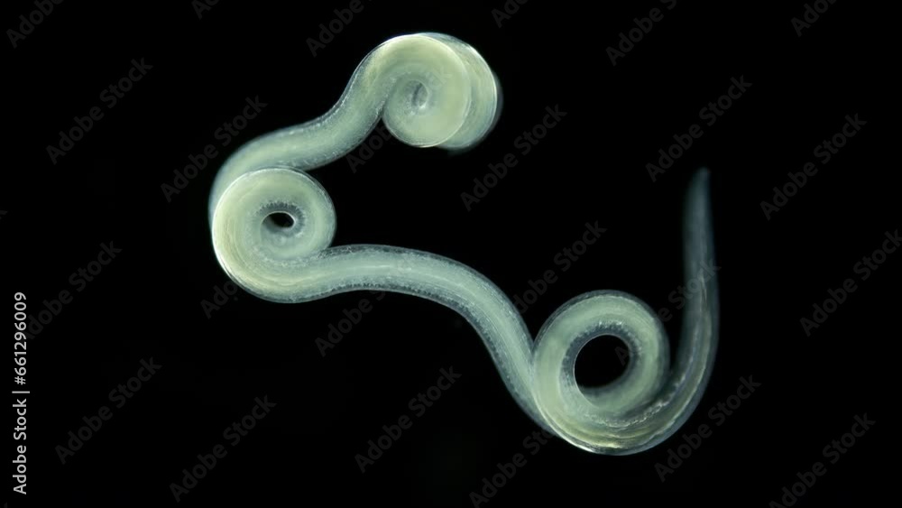 worm Nematoda under microscope, Phylum Protostomia, free-living ...