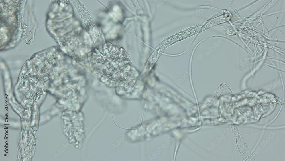 Larvae of parasitic worm Progonus muelleri under a microscope, at ...