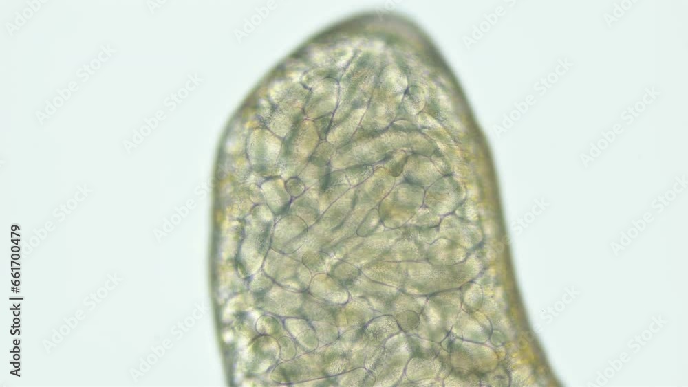 Sporocyst stage of parasitic worm Podocotyle sp. under a microscope ...