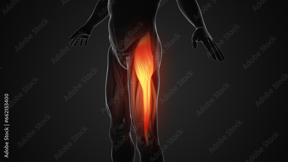 Pain and injury in the Tensor Fasciae Latae Muscles Stock Illustration ...