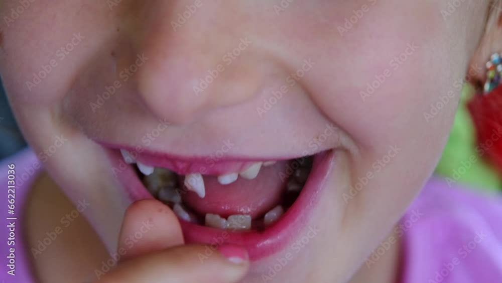 The child shakes the front baby tooth and smiles a toothless smile ...
