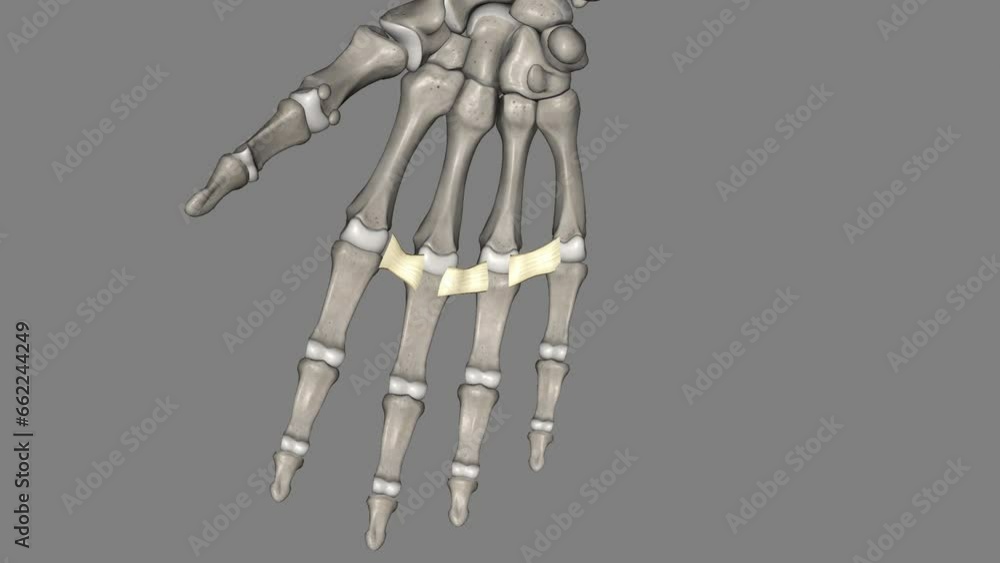 The deep transverse metacarpal ligament connects the palmar surfaces of ...