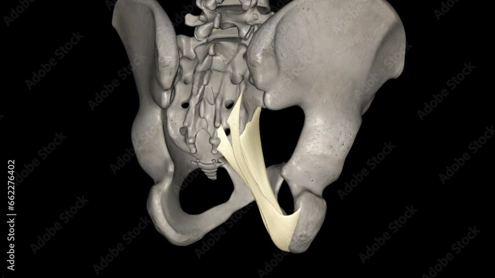 The sacrotuberous ligament (STL) is a stabiliser of the sacroiliac ...
