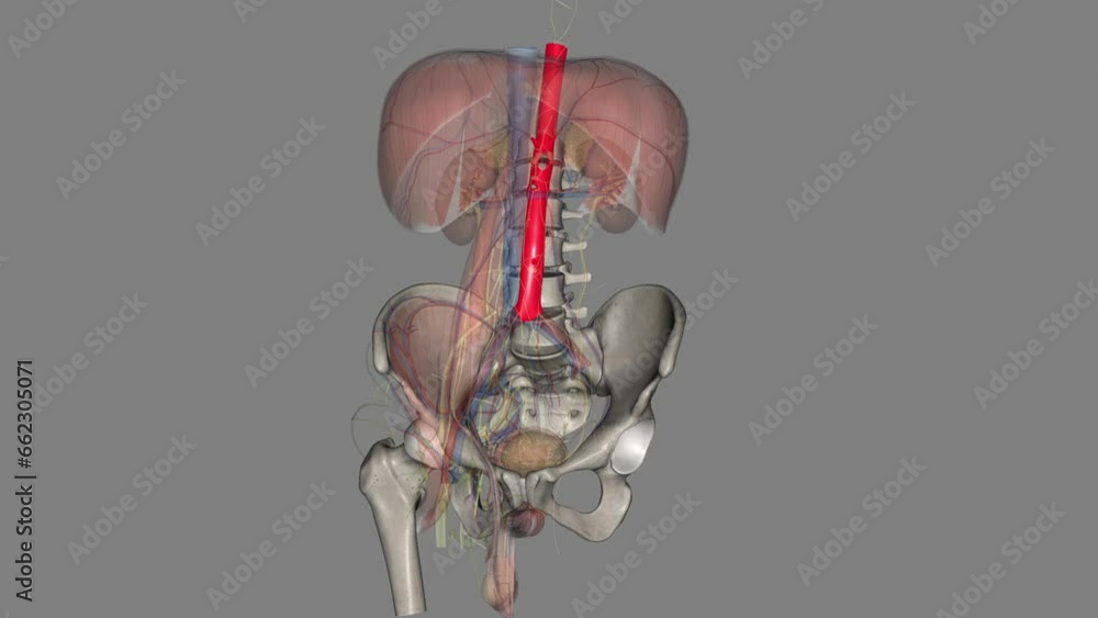 An abdominal aortic aneurysm is an enlarged area in the lower part of ...
